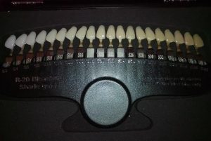 Vitapan Shade Guide - Youth Beauty